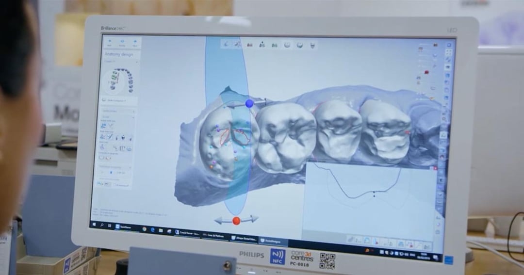 NextDent 5100 - 3D 프린터 | 3D Systems