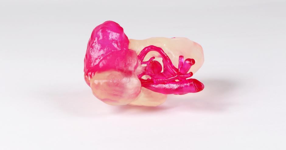 Medical model - 3D Printed Kidney Replica | 3D Systems